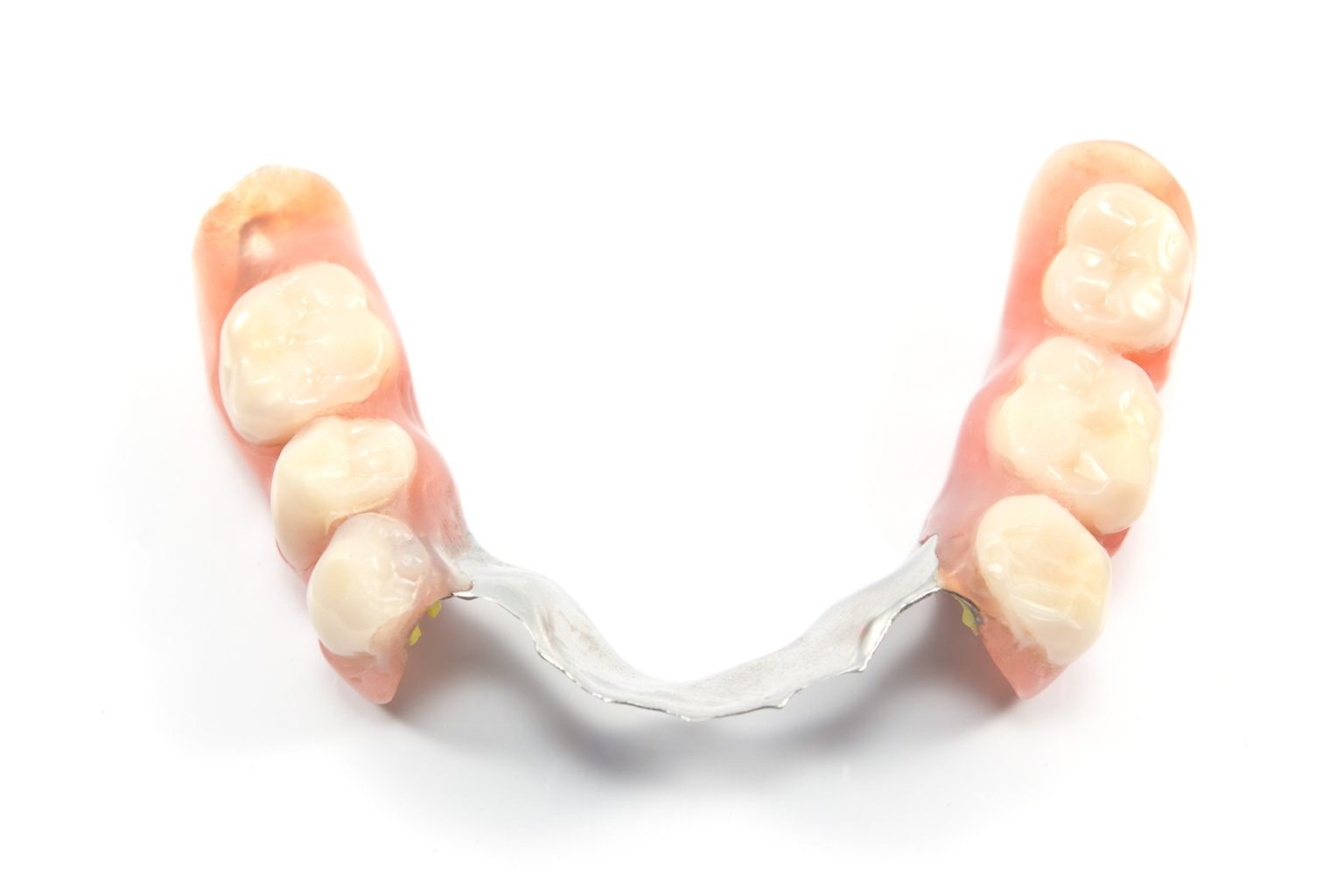 The Difference Between Partial Dentures and Dental Bridges