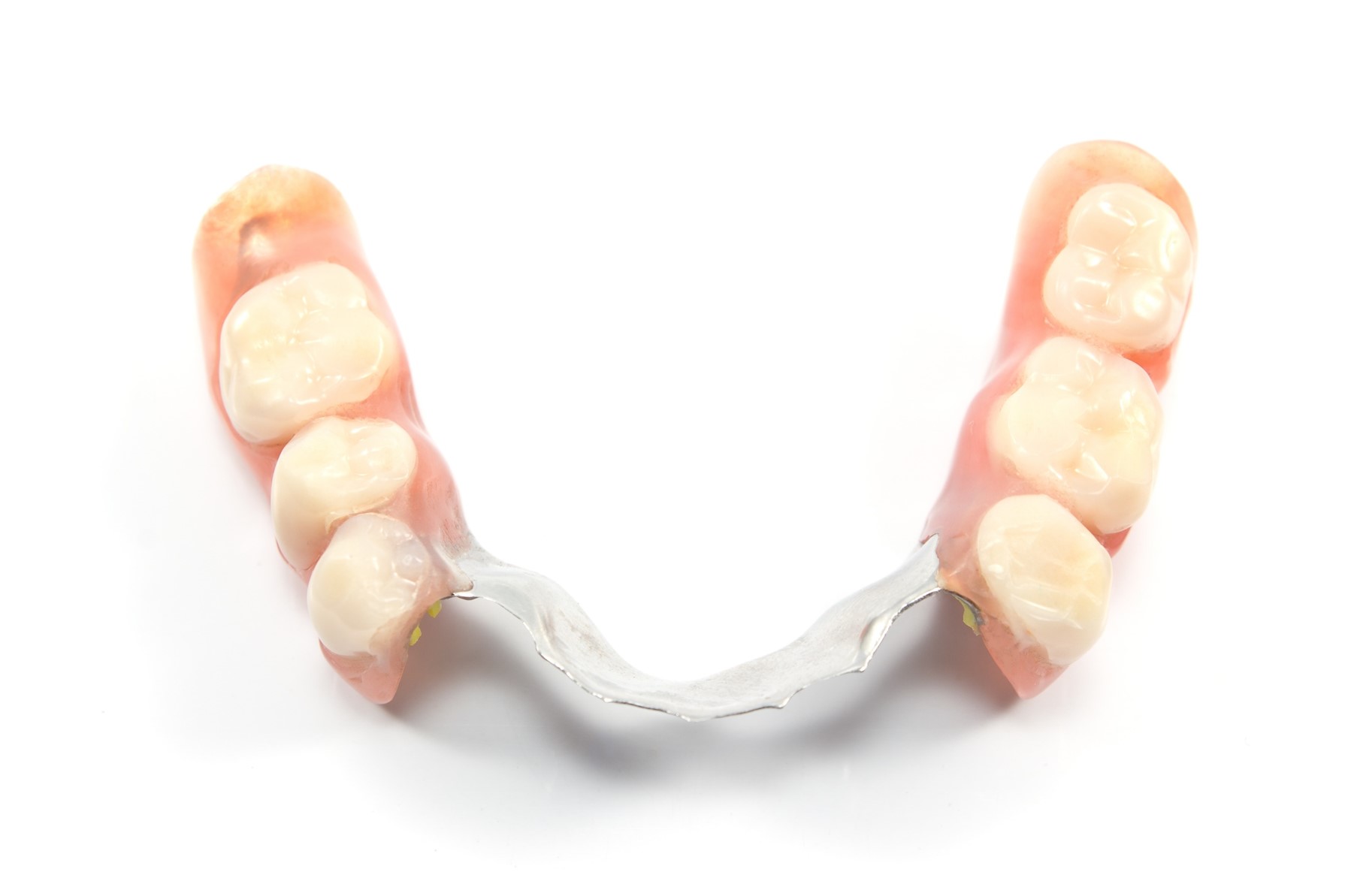 The Difference Between Partial Dentures and Dental Bridges